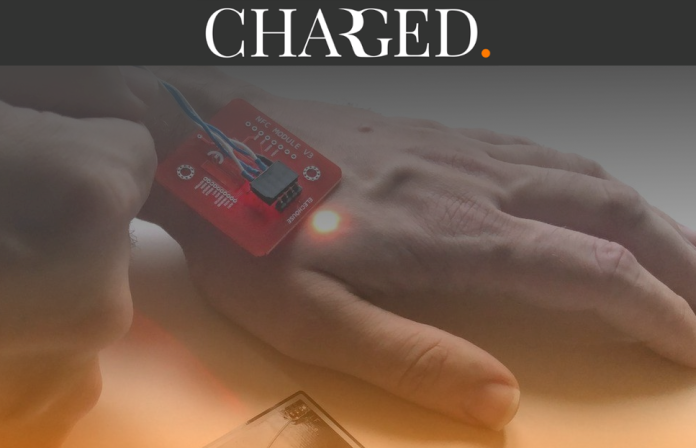 You can now pay with an implant in your hand - Retail Gazette